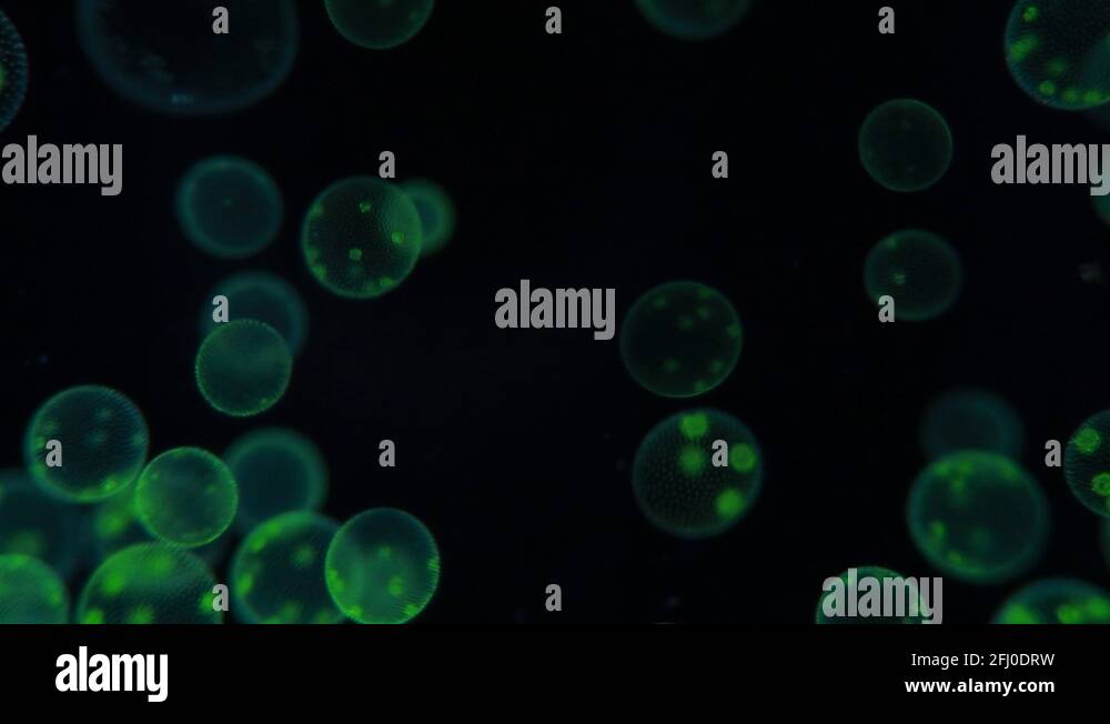 Volvox Aureus bacteria colonies in darkfield microsopy, cells ...
