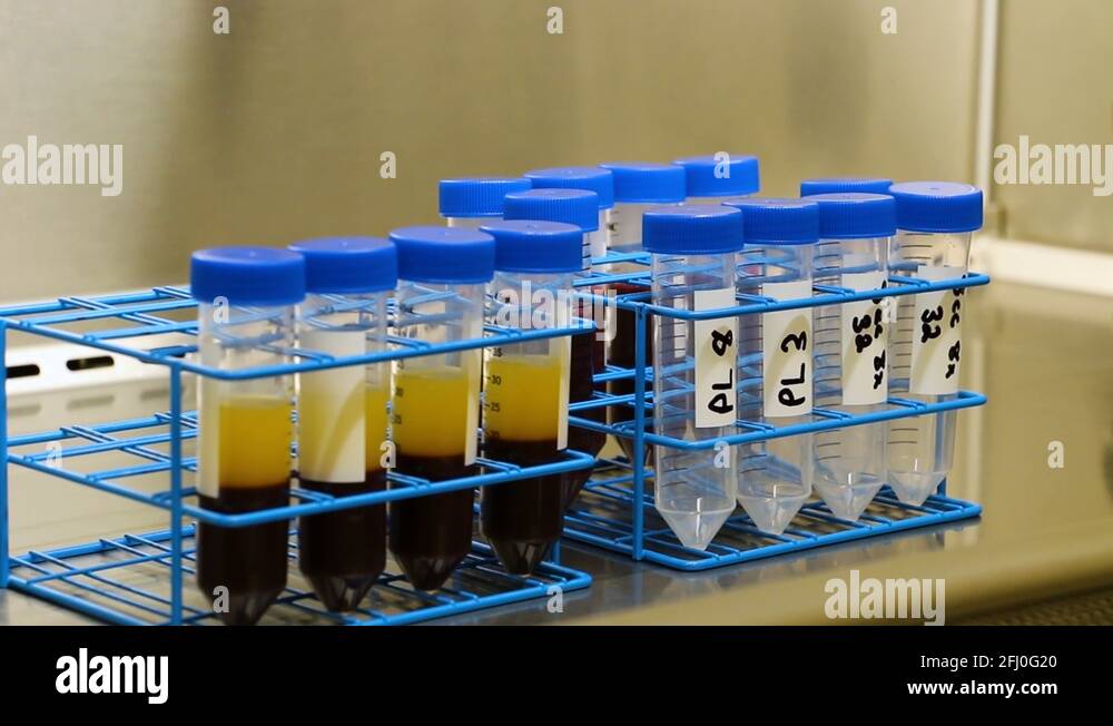 Blood centrifuge separated Stock Videos & Footage - HD and 4K Video ...