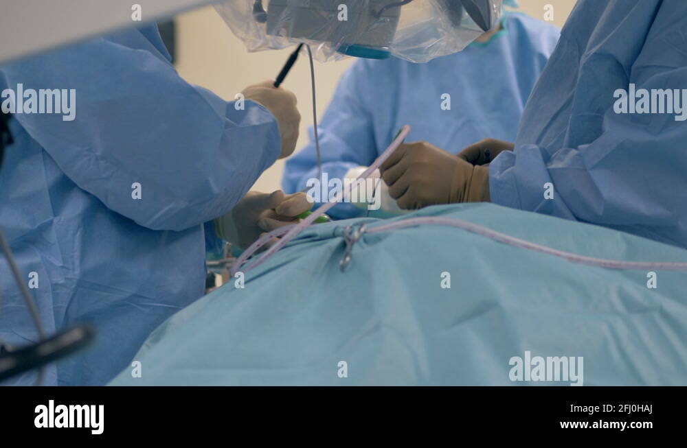Surgeons surgery team Stock Videos & Footage - HD and 4K Video Clips ...