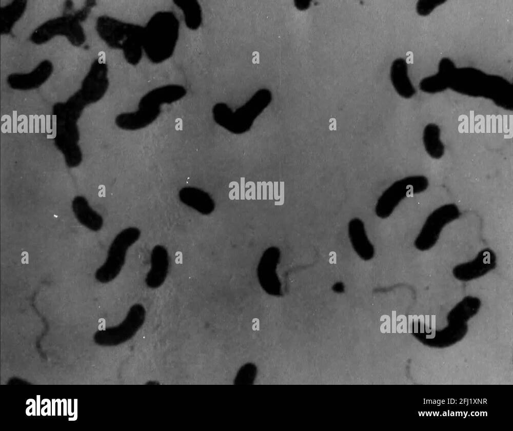 Germs and diseases Stock Videos & Footage - HD and 4K Video Clips - Alamy