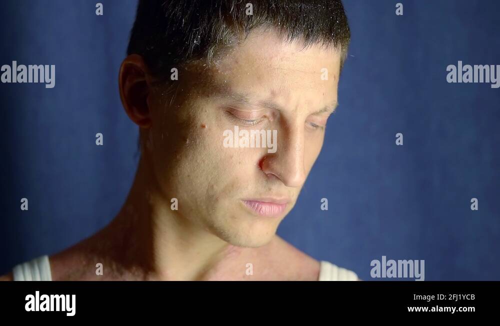 Wound blue skin Stock Videos & Footage - HD and 4K Video Clips - Alamy