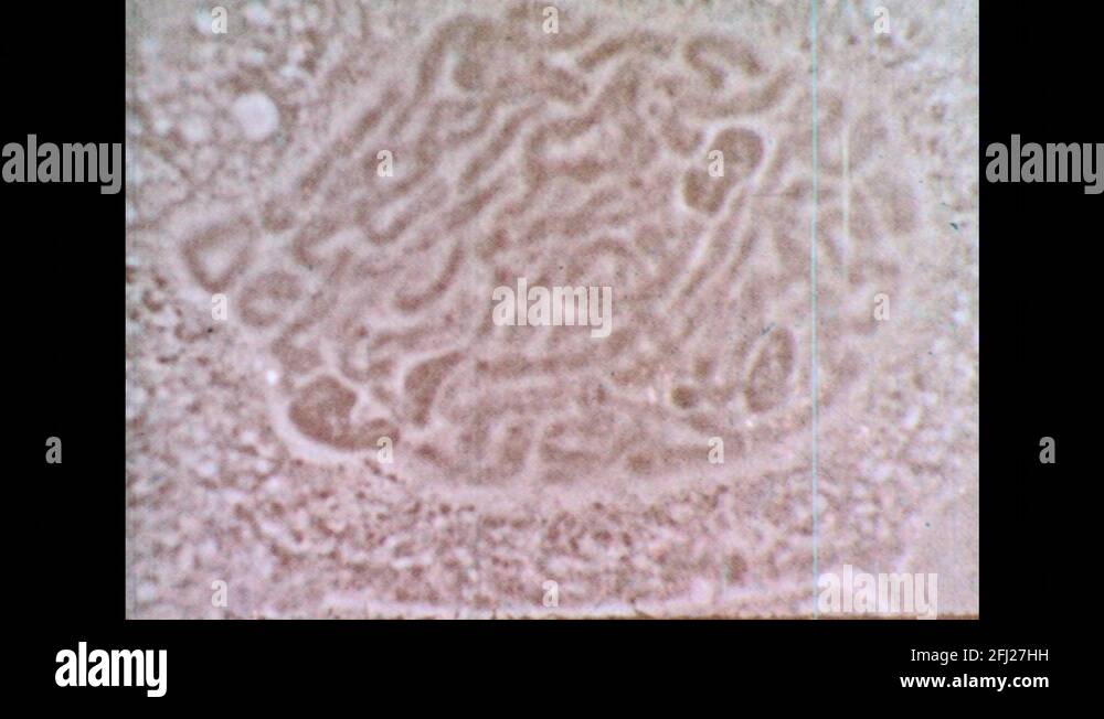 Chromosomes microscope Stock Videos & Footage - HD and 4K Video Clips ...