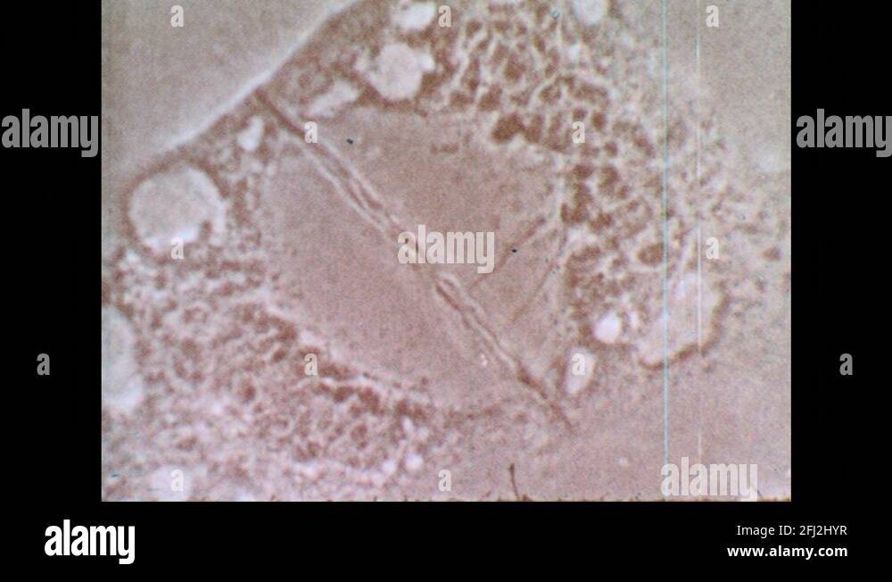 Eye lens cell Stock Videos & Footage - HD and 4K Video Clips - Alamy