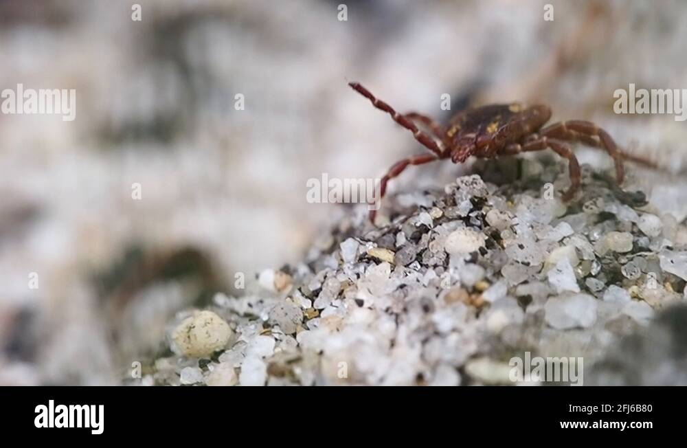 Venom removal Stock Videos & Footage - HD and 4K Video Clips - Alamy