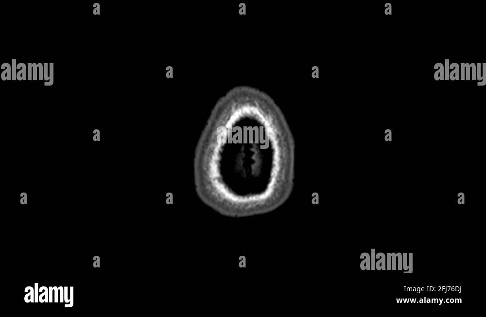 Human head mri brain scan Stock Videos & Footage - HD and 4K Video ...