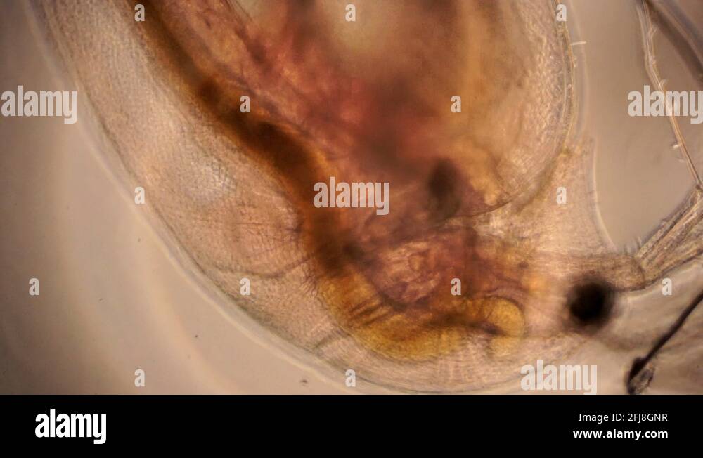 Internal anatomy of the water flea, Daphnia. Microscopic features such ...