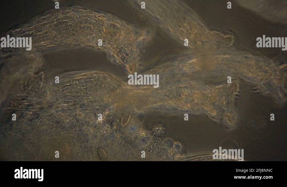 Ciliate microscopic through microscope Stock Videos & Footage - HD and ...