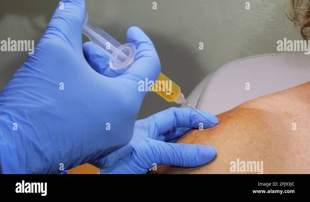 Shoulder pain injection Stock Videos & Footage - HD and 4K Video Clips ...