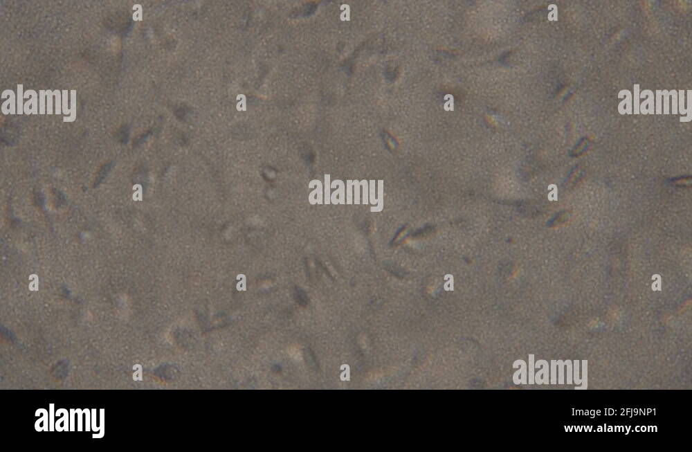Sperm (spermatozoa) viewed under the microscope. Moving human sperm ...