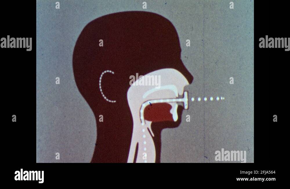 1950s: Animation. Lines show how air enters lungs with airway inserted ...