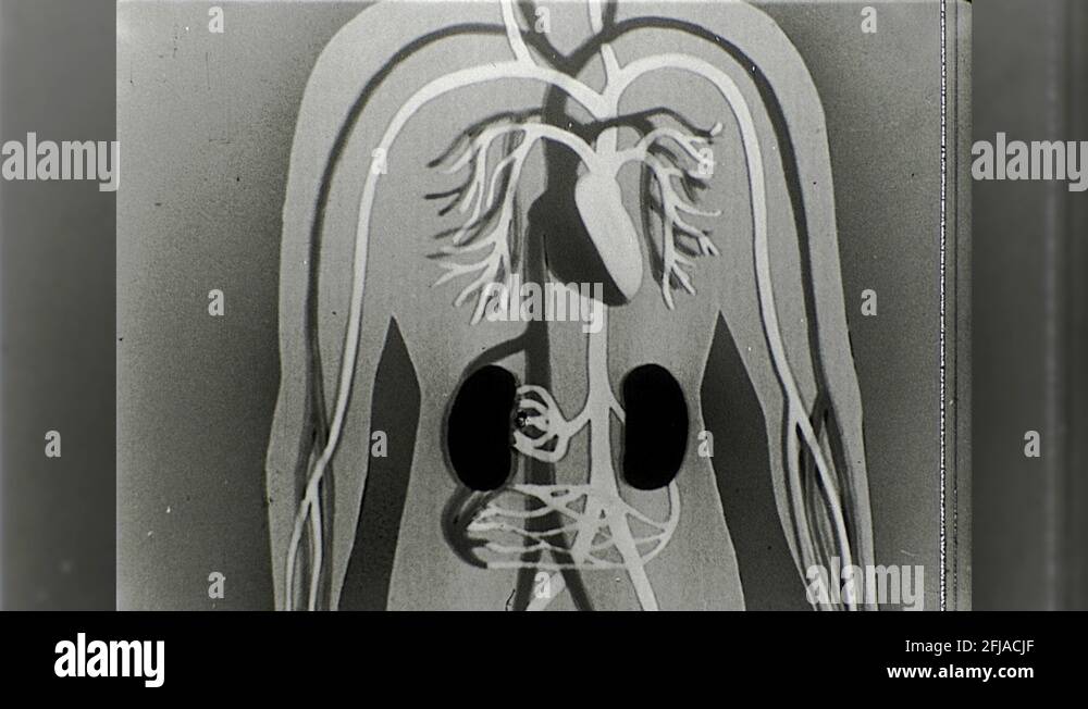 1970s Kidney Renal Organ Medical Graphic Chart Human Body Vintage Old ...