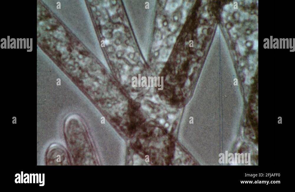 1960s: UNITED STATES: plants under microscope. Filaments on algae. Long ...