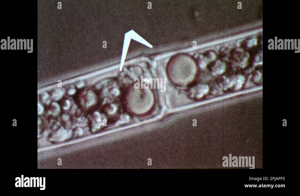 1960s: UNITED STATES: golden droplets under microscope. Filaments on ...