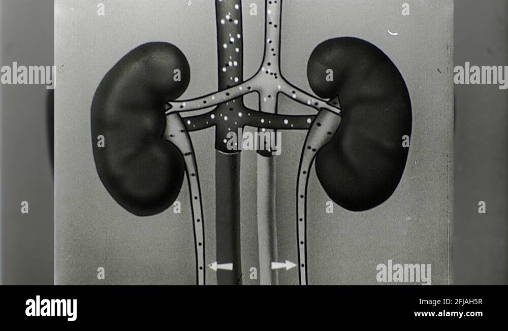 1970s Kidney Renal Organ Medical Graphic Chart Human Body Vintage Old ...