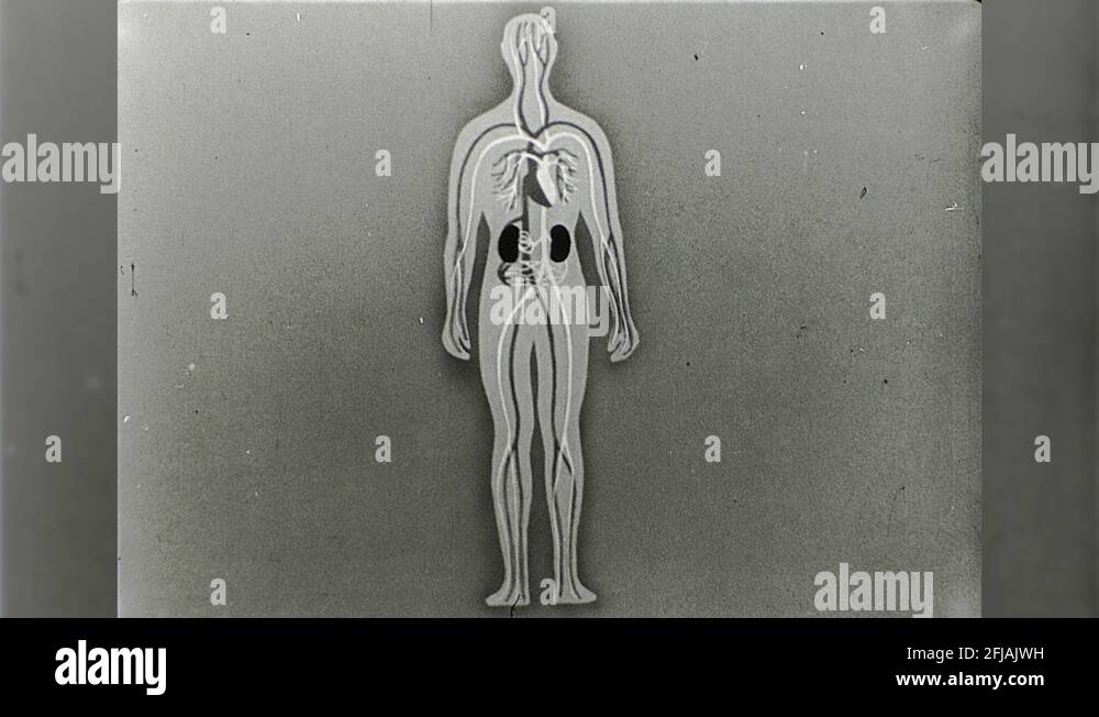 1970s Kidney Renal Organ Medical Graphic Chart Human Body Vintage Old ...