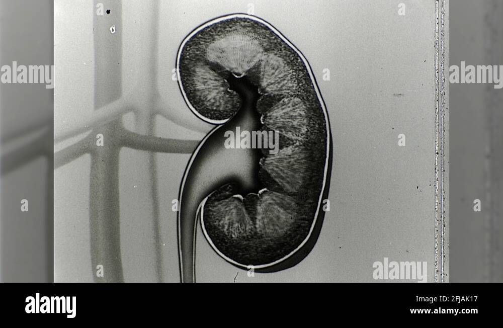 1970s Kidney Renal Organ Medical Graphic Chart Human Body Vintage Old ...