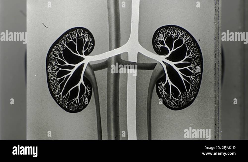 1970s Kidney Renal Organ Medical Graphic Chart Human Body Vintage Old ...