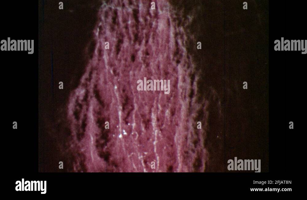 1960s: UNITED STATES: pattern of algae under microscope. Red tide in ...