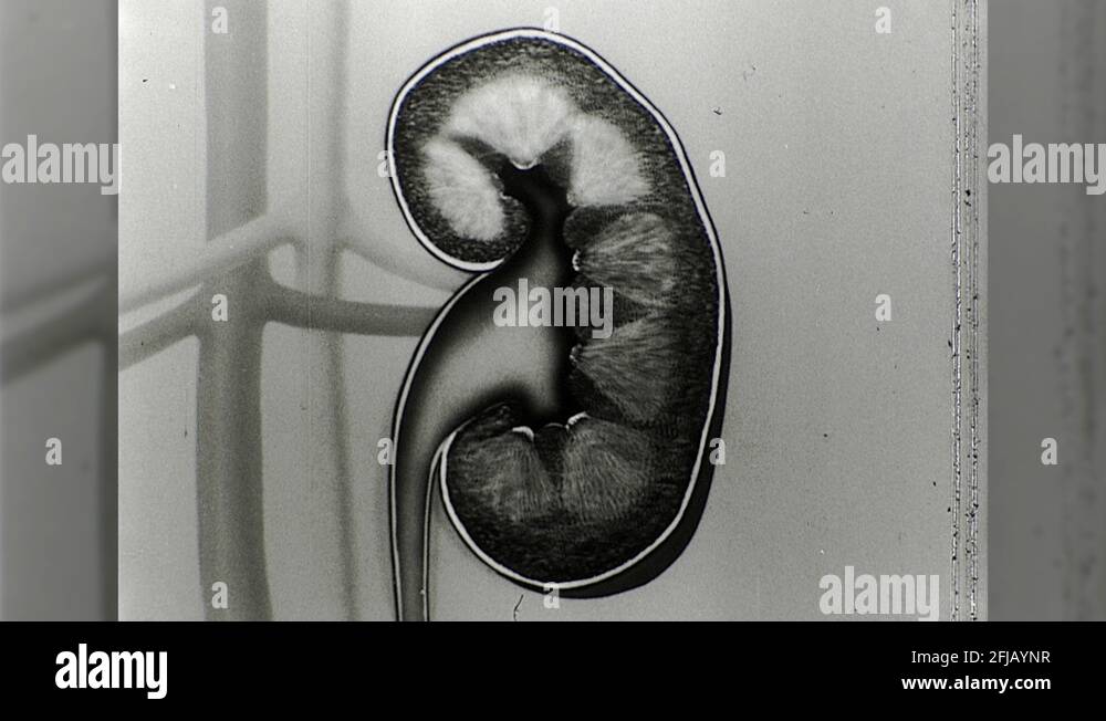 1970s Kidney Renal Organ Medical Graphic Chart Human Body Vintage Old ...