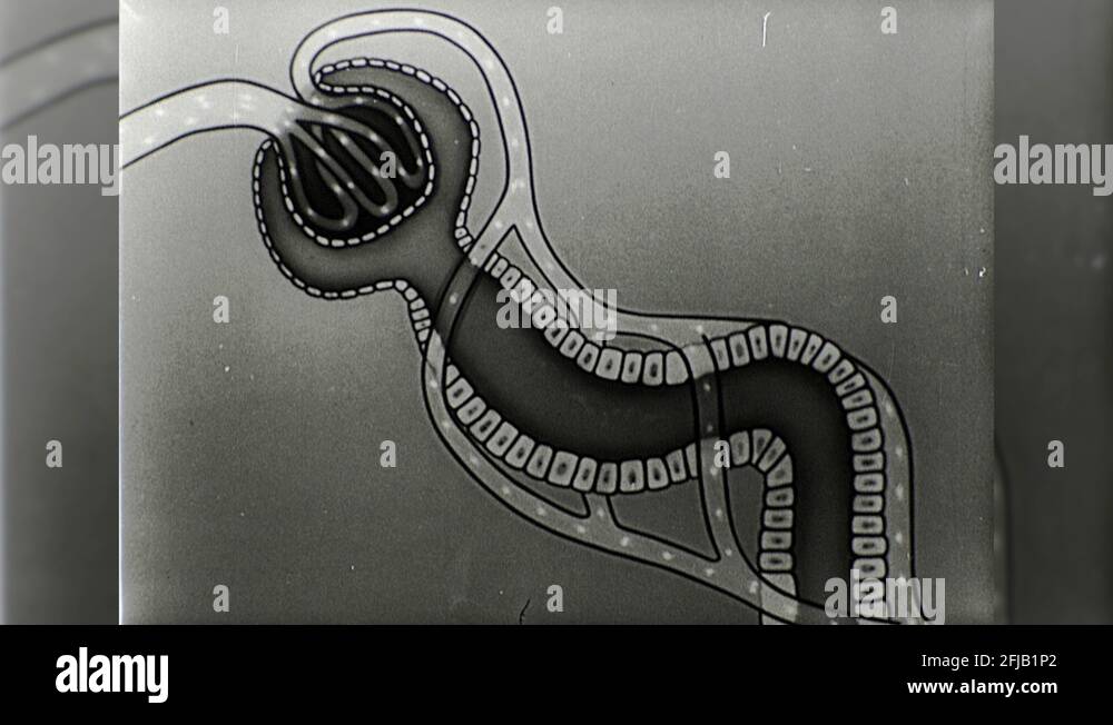 1970s Kidney Renal Organ Medical Graphic Chart Human Body Vintage Old ...