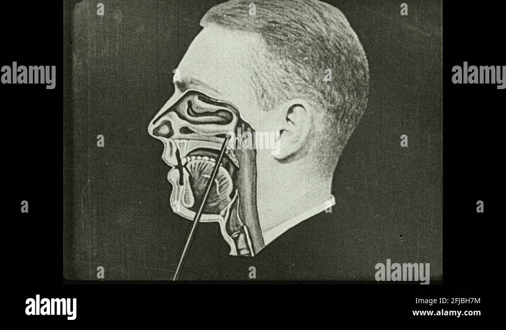 Voice box anatomy Stock Videos & Footage - HD and 4K Video Clips - Alamy