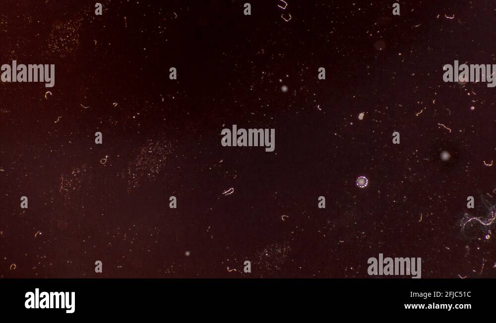 Pathogen bacteria Stock Videos & Footage - HD and 4K Video Clips - Alamy