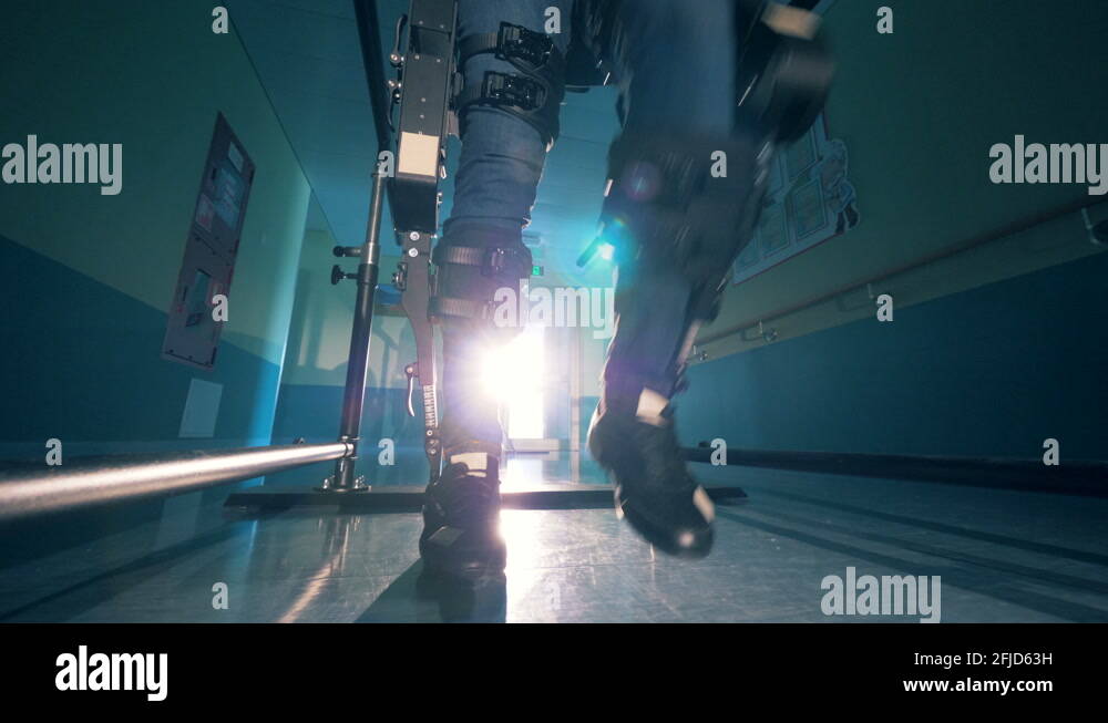 Mechanical prosthesis Stock Videos & Footage - HD and 4K Video Clips ...