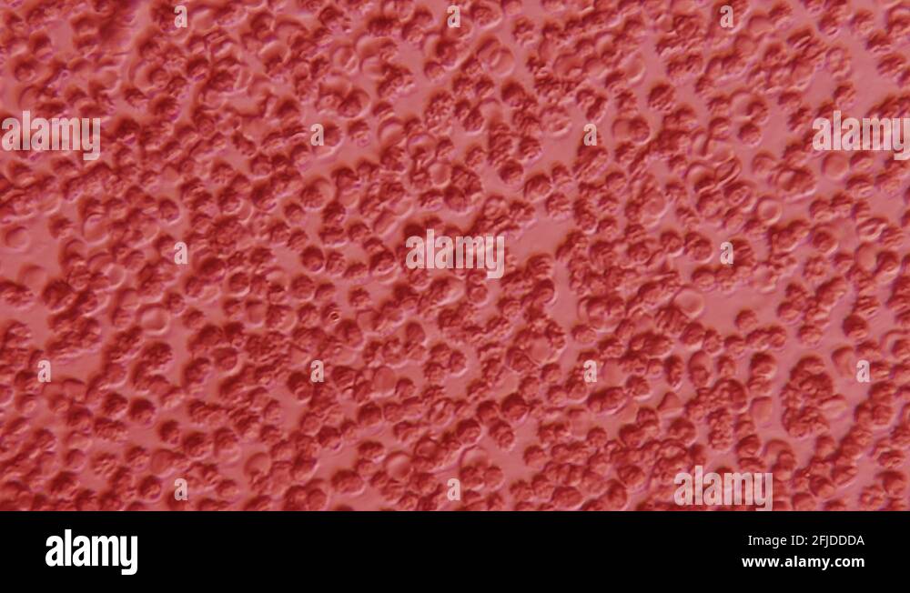 Red Blood with Burr Cells 600x Phase Microscope Stock Video Footage - Alamy
