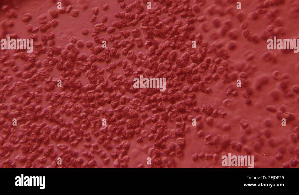 Red blood cell microscope Stock Videos & Footage - HD and 4K Video ...