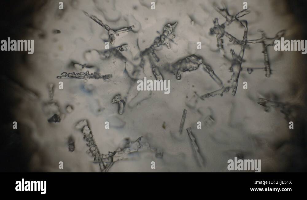 Ice microscope Stock Videos & Footage - HD and 4K Video Clips - Alamy