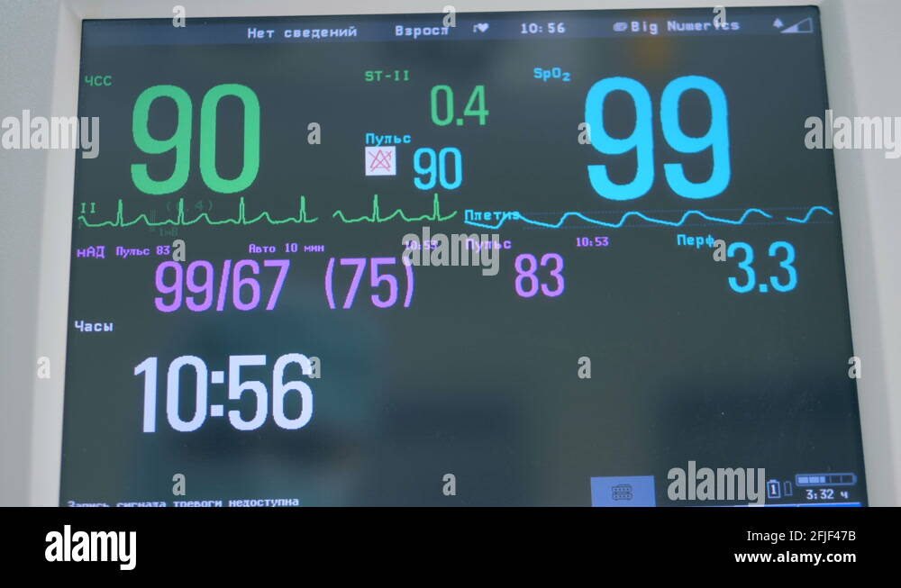 Ambulatory ekg Stock Videos & Footage - HD and 4K Video Clips - Alamy