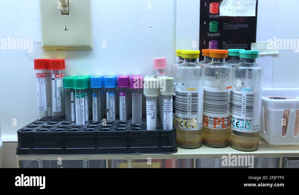 Medical blood test tubes equipment Stock Videos & Footage - HD and 4K ...