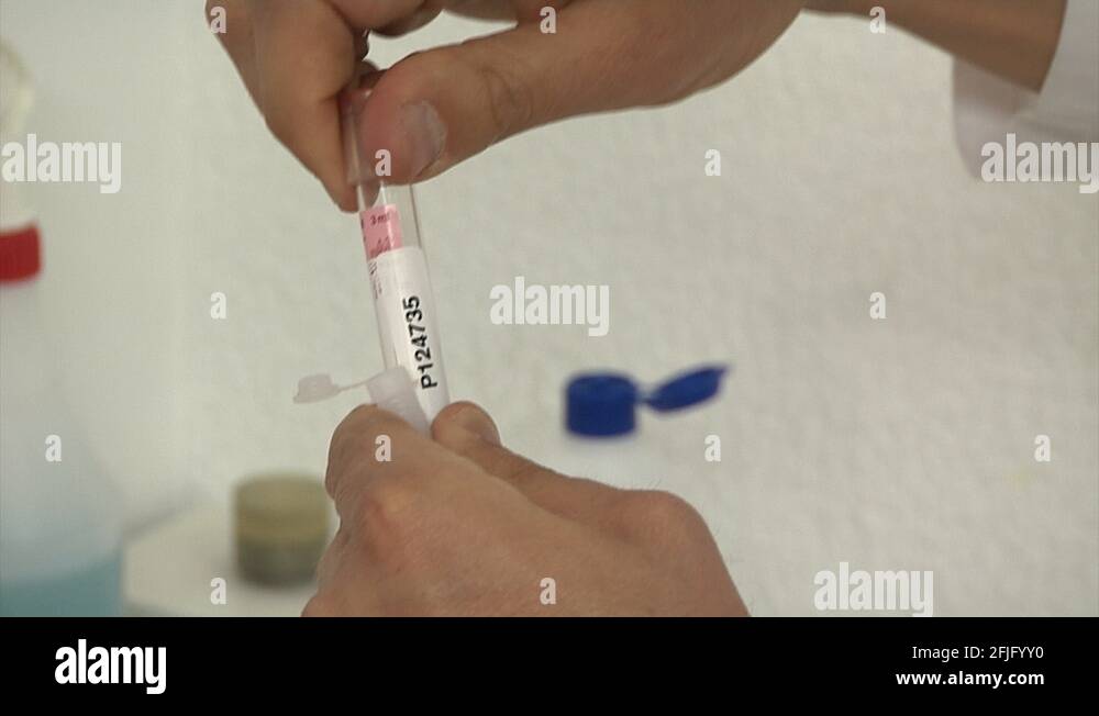 Close-up of a lab tech using a pipette to draw a sample from a glass ...