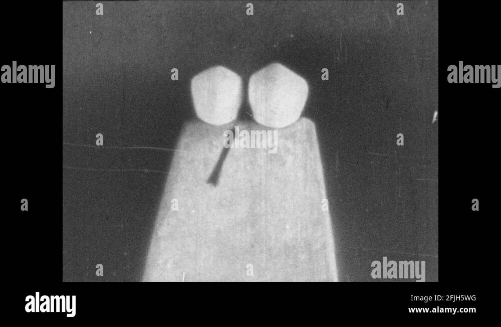 Anatomical space Stock Videos & Footage - HD and 4K Video Clips - Alamy