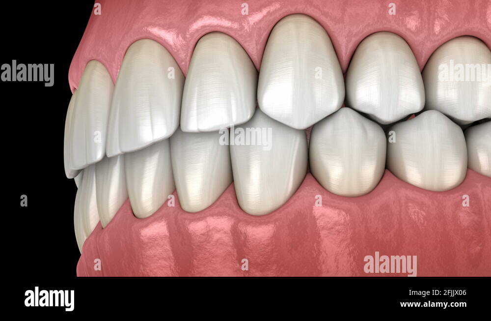 Healthy human teeth with normal occlusion, side view. Medically ...
