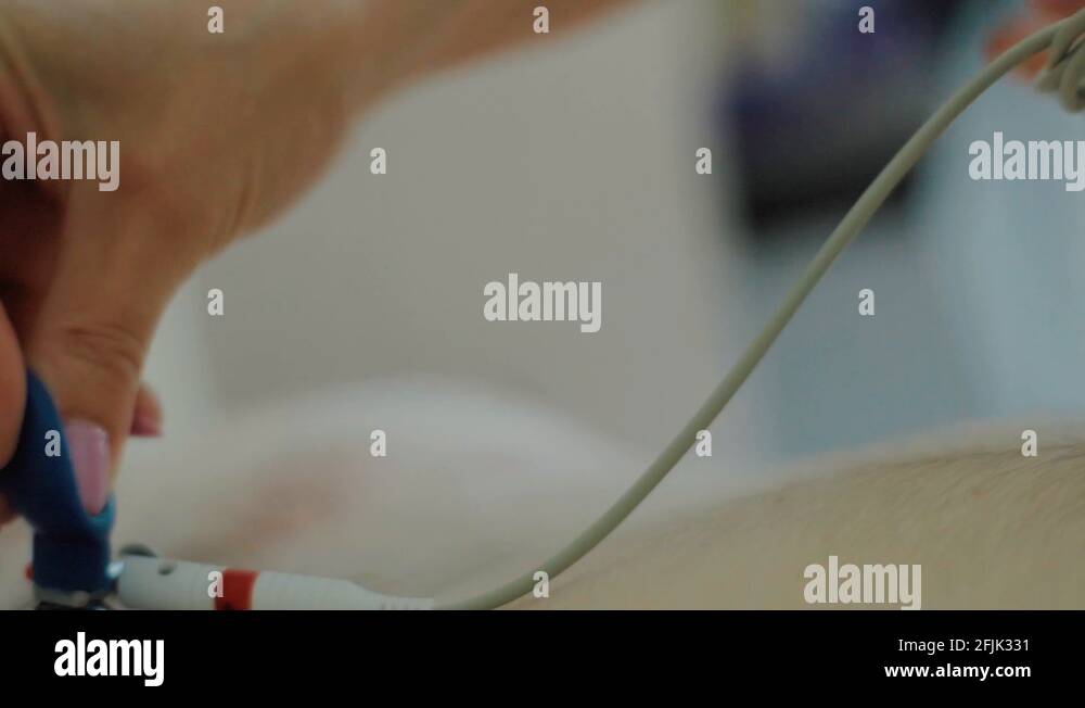 Ecg patient Stock Videos & Footage - HD and 4K Video Clips - Alamy