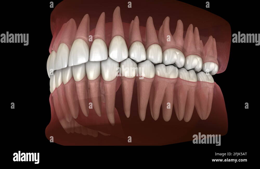 Maxillary teeth Stock Videos & Footage - HD and 4K Video Clips - Alamy