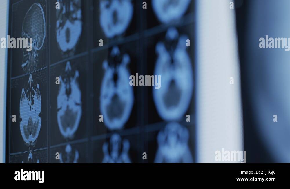 Brain scans Stock Videos & Footage - HD and 4K Video Clips - Alamy