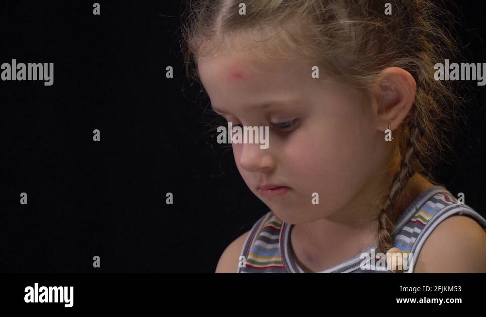 Little kid with blue eyes and bruises on her face, child abuse, social ...