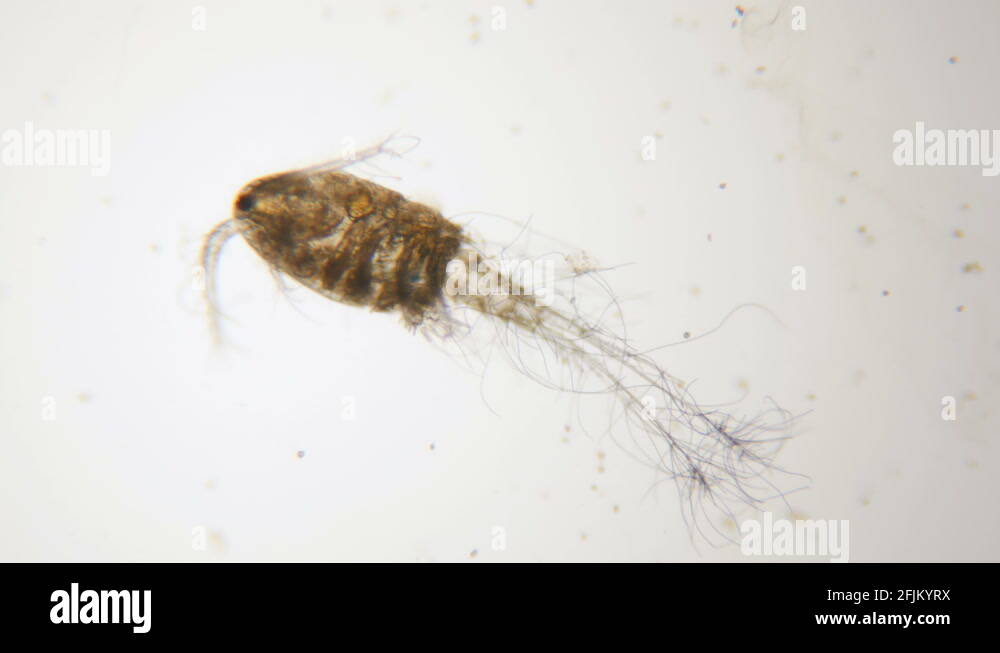 Male cyclops under the microscope in lake water. Close up. UHD 4K Stock ...