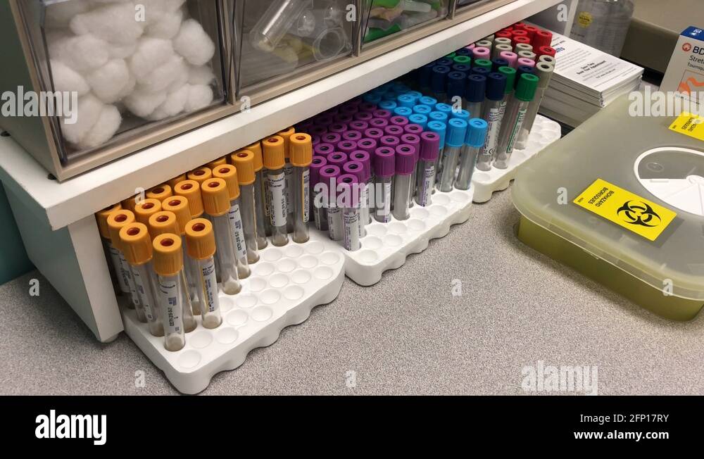 Blood samples in blood collection Stock Videos & Footage - HD and 4K ...
