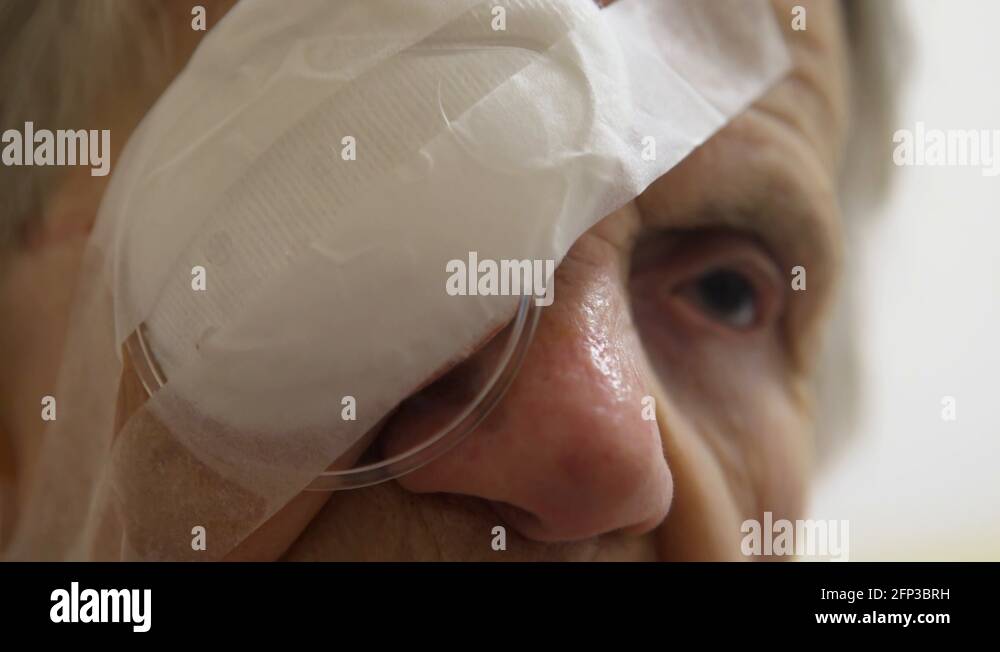 Cured face Stock Videos & Footage - HD and 4K Video Clips - Alamy