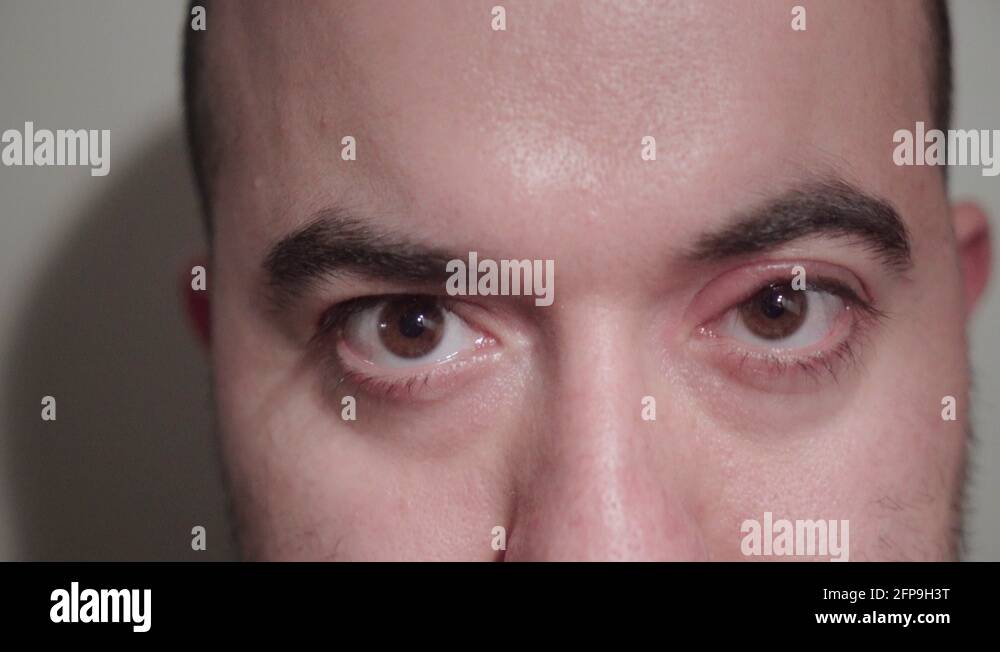 Portrait man swollen face Stock Videos & Footage - HD and 4K Video ...