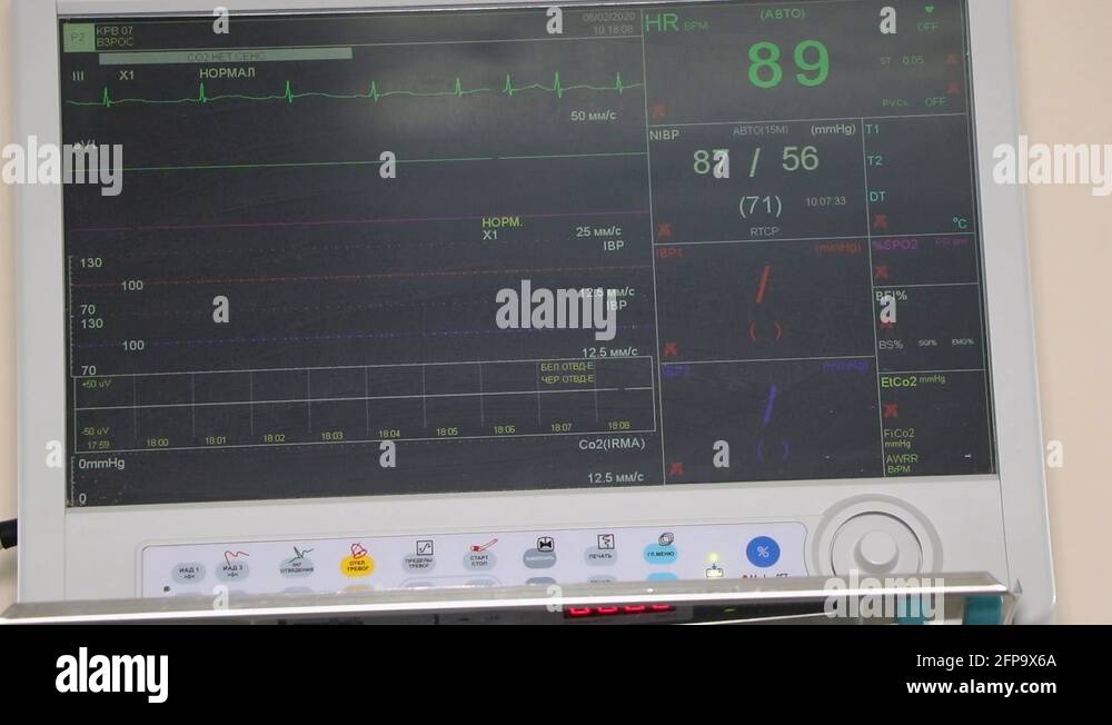 Heart and patient monitor showing patient vital signs Stock Video ...