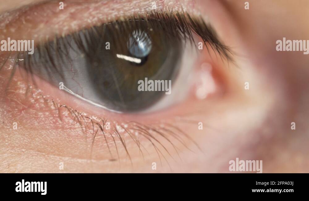 Blinded vision Stock Videos & Footage - HD and 4K Video Clips - Alamy