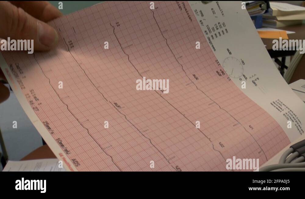 Ekg readout Stock Videos & Footage - HD and 4K Video Clips - Alamy