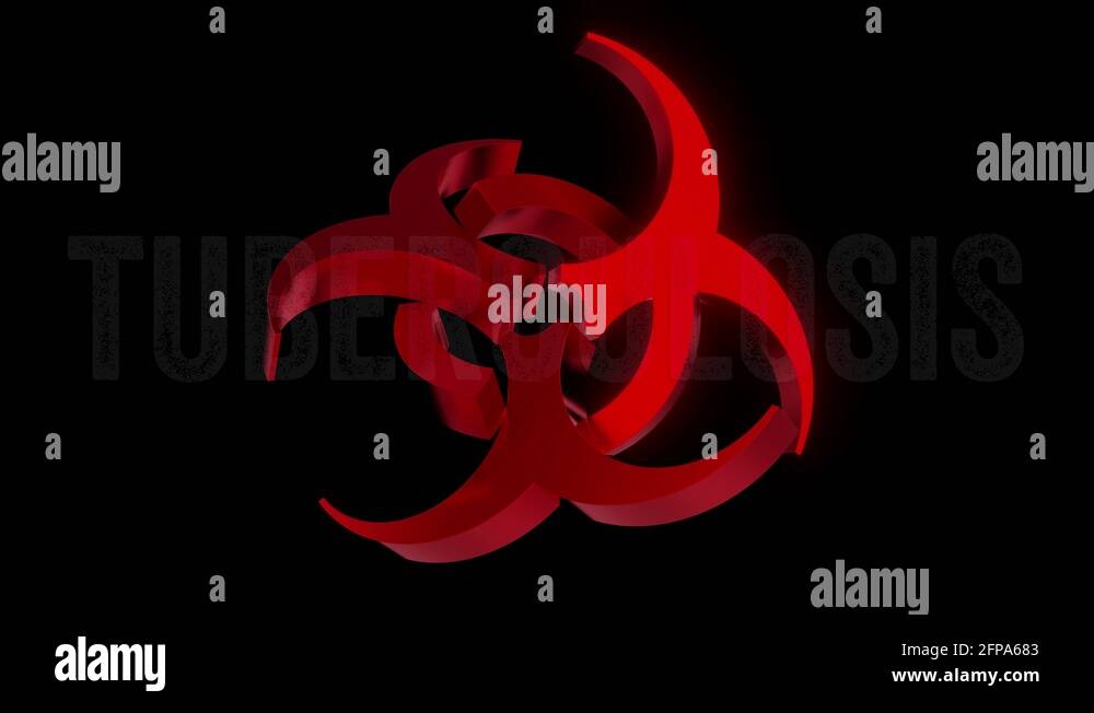 Tuberculosis consumption Stock Videos & Footage - HD and 4K Video Clips ...