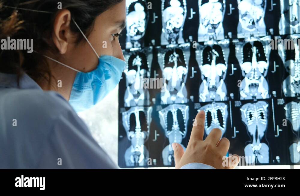 Abdomen mri scan Stock Videos & Footage - HD and 4K Video Clips - Alamy