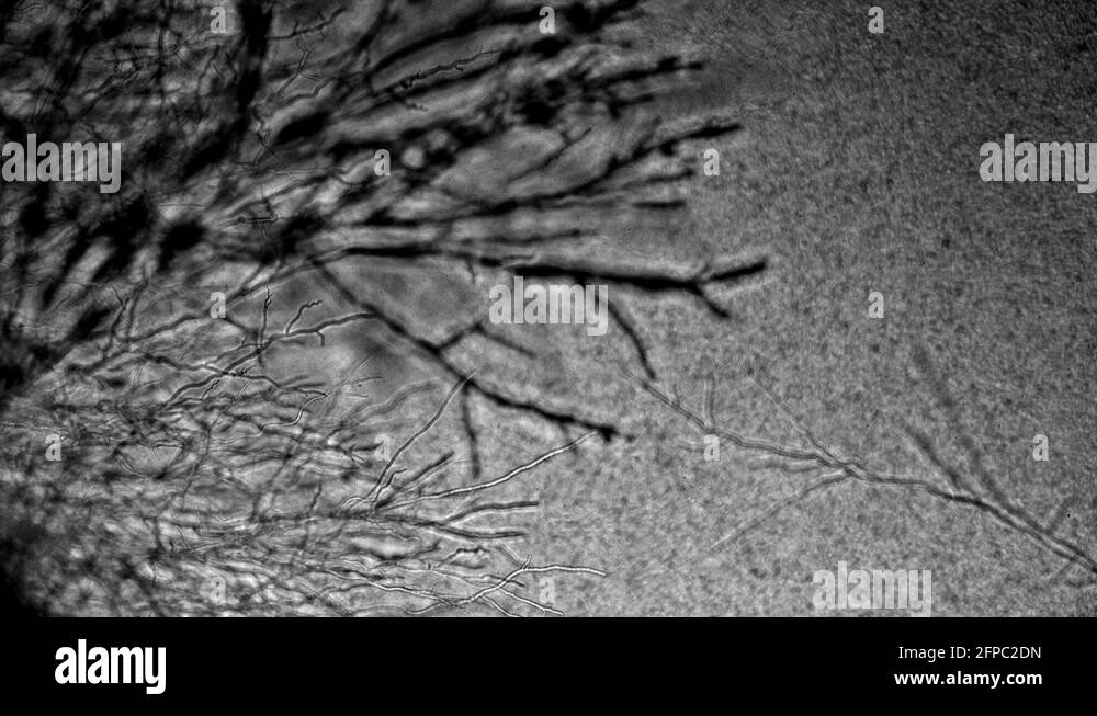 Mould microscope Stock Videos & Footage - HD and 4K Video Clips - Alamy