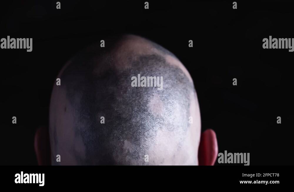 Dark patch head Stock Videos & Footage - HD and 4K Video Clips - Alamy